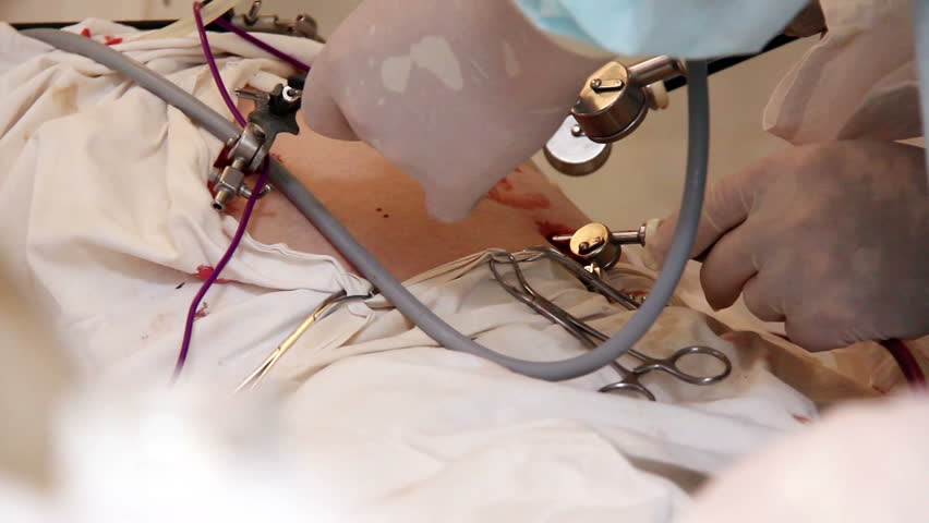 Endoscopy Definition 2386