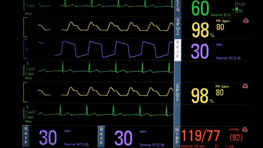 Looping Animation Of A Medical Hospital Monitor Of Normal Vital Signs ...